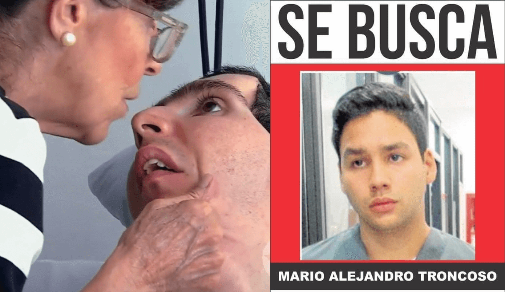 Fallece Joven Mejía Flomin Dejado En Estado Vegetativo Tras Brutal
